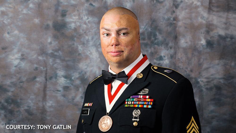 Staff Sgt. Shilo Harris, 'The Man of Steel Will' | CBN News